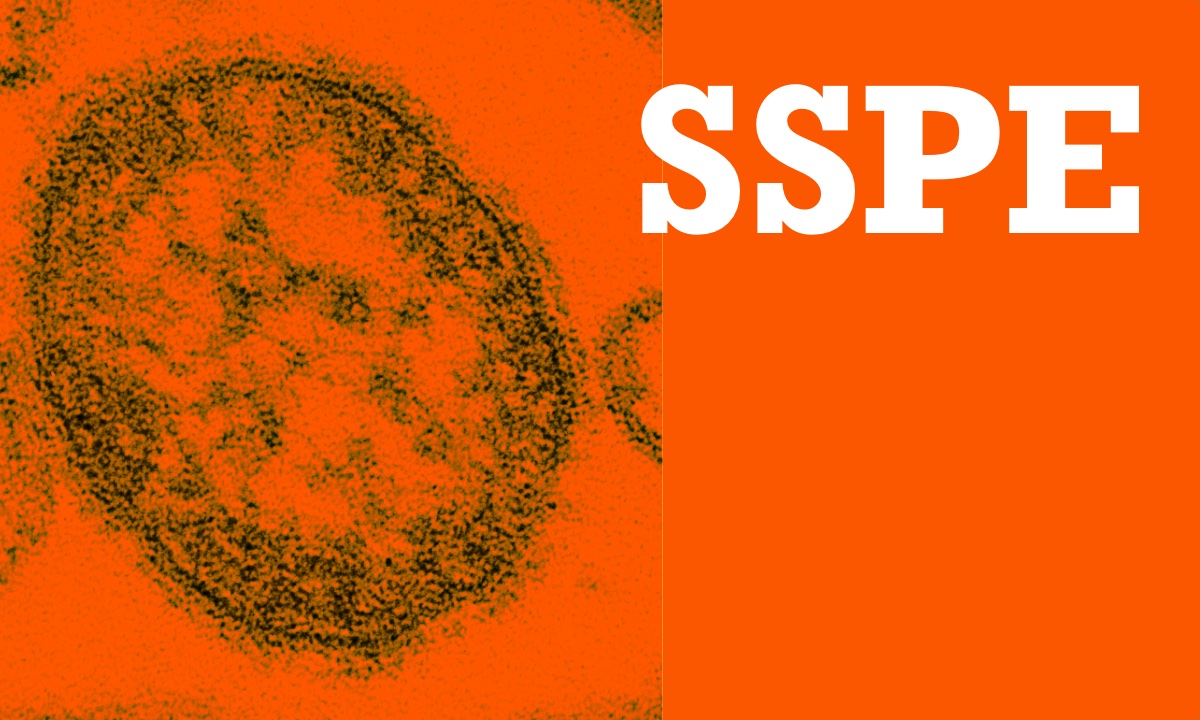 Subakute sklerosierende Panenzephalitis (SSPE) – brainpainblog