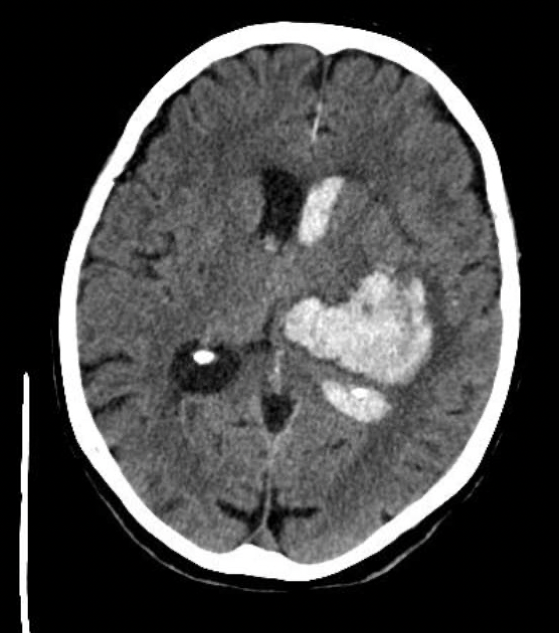 2021 – brainpainblog