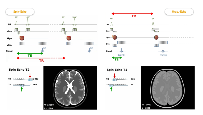 Neuroradiologie 101: MRT für Neurologen – brainpainblog